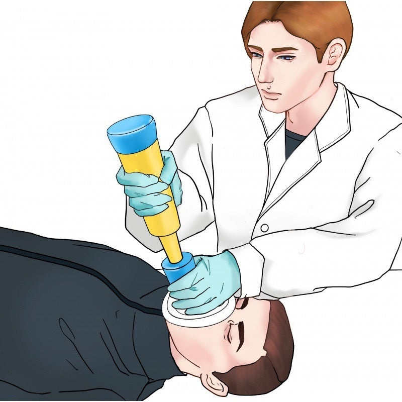 Choking Rescue Device – Checksyde